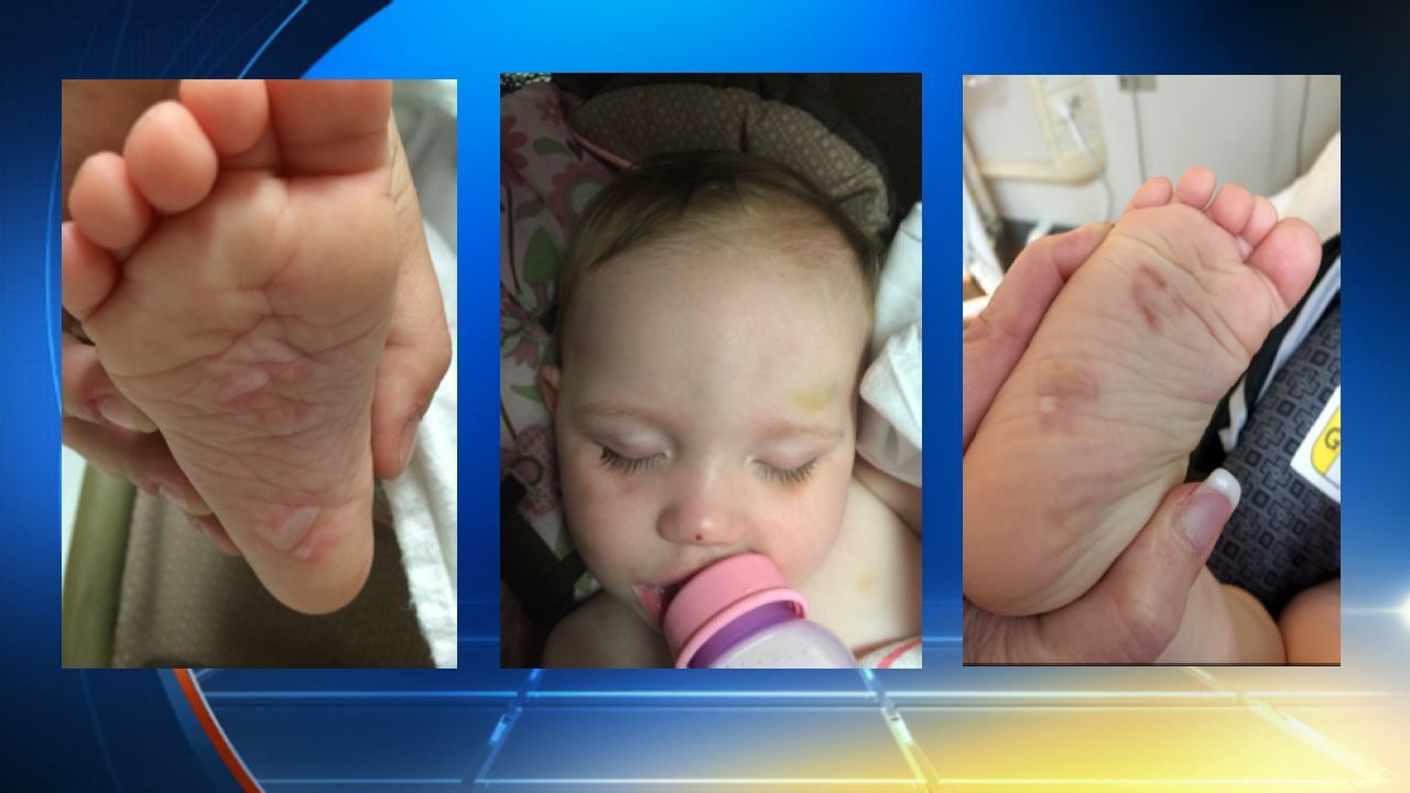 Man arrested for second child abuse charge after burning,...